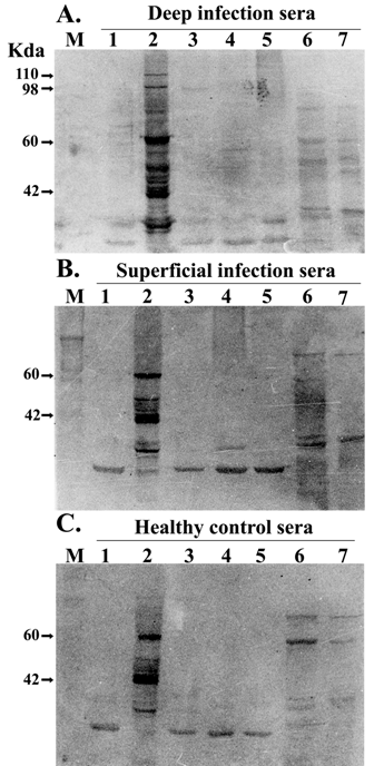 A comparative analysis of antibody repertoire against Staphylococcus ...
