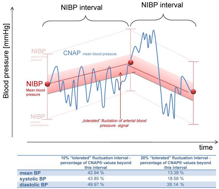 Continuous Non-Invasive Arterial Pressure Technique Improves Patient ...