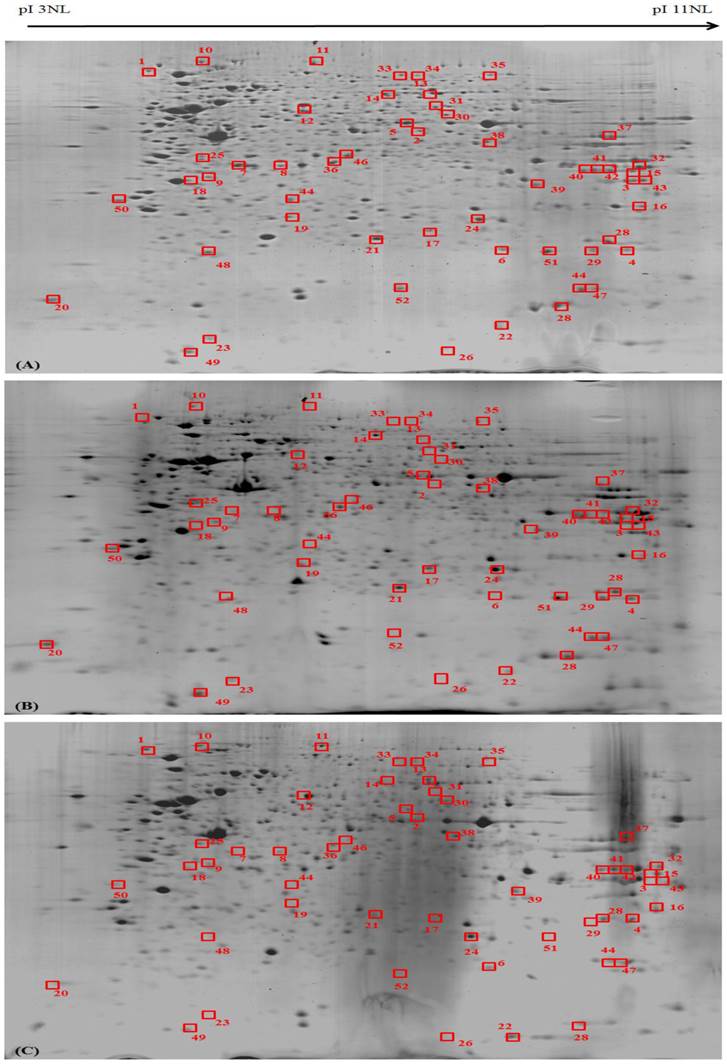 Inhibition of MAPKs, Myc/Max, NFκB, and Hypoxia Pathways by Phyllanthus ...