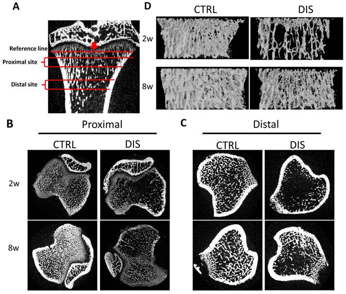 Paradoxical Response to Mechanical Unloading in Bone Loss ...