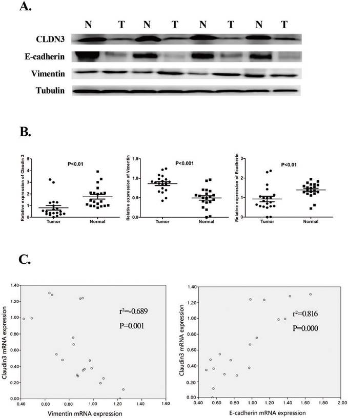 Claudin-3 Inhibits Lung Squamous Cell Carcinoma Cell Epithelial ...