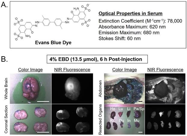 Low-Dose Evans Blue Dye for Near-Infrared Fluorescence Imaging in ...