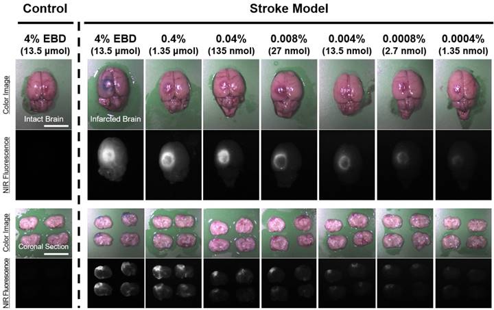Low-Dose Evans Blue Dye for Near-Infrared Fluorescence Imaging in ...