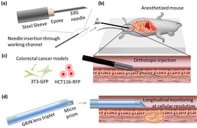 Longitudinal micro-endoscopic monitoring of high-success intramucosal ...