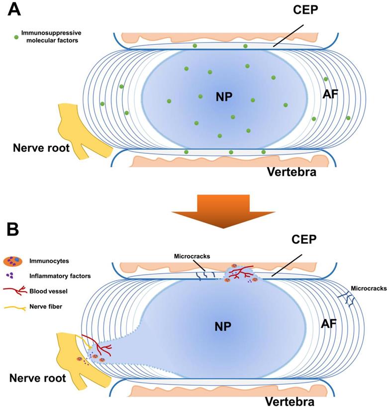 The Immune Privilege of the Intervertebral Disc: Implications for ...