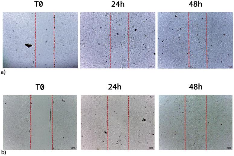 Fibroblast Proliferation and Migration in Wound Healing by ...