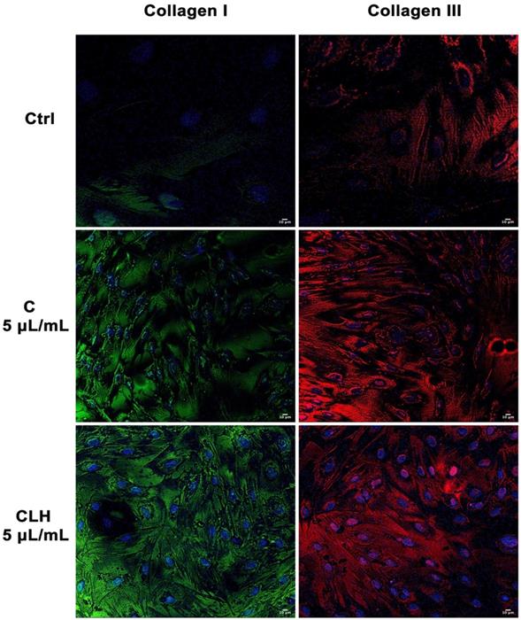 Fibroblast Proliferation and Migration in Wound Healing by ...