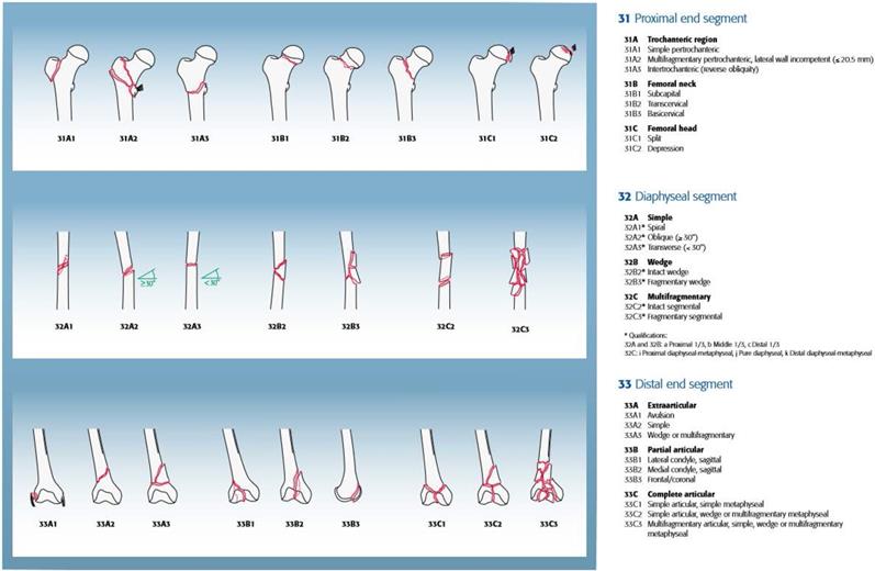 Incidence and treatment of adult femoral fractures with osteogenesis ...