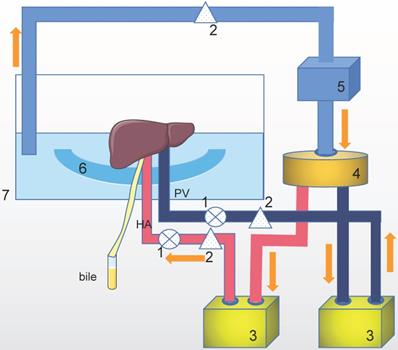 Research progress on hepatic machine perfusion