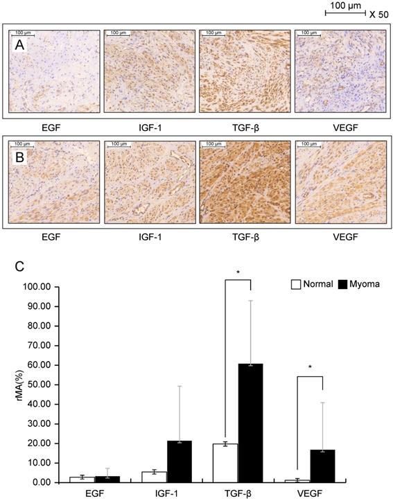 The Potential of Transforming Growth Factor-beta Inhibitor and Vascular ...