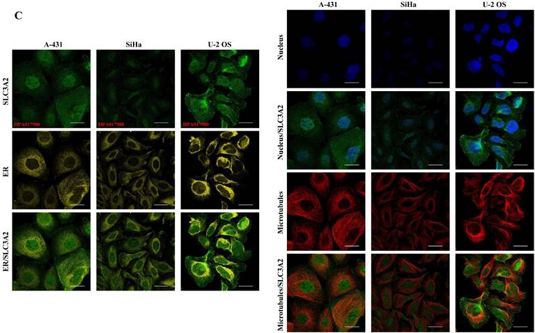 Integrated analysis of FKBP1A/SLC3A2 axis in everolimus inducing ...