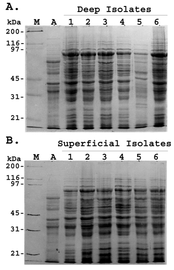 A comparative analysis of antibody repertoire against Staphylococcus ...