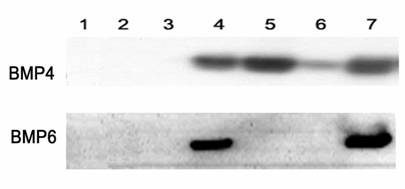 Comparison of osteogenic potentials of human rat BMP4 and BMP6 gene ...