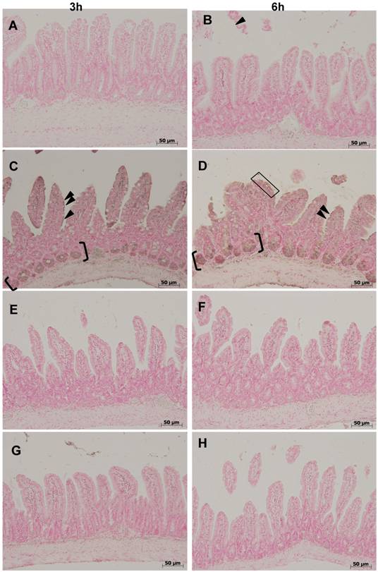 Infliximab and Etanercept Are Equally Effective in Reducing Enterocyte ...