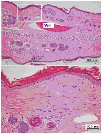 Methods of preventing vinorelbine-induced phlebitis: an experimental ...