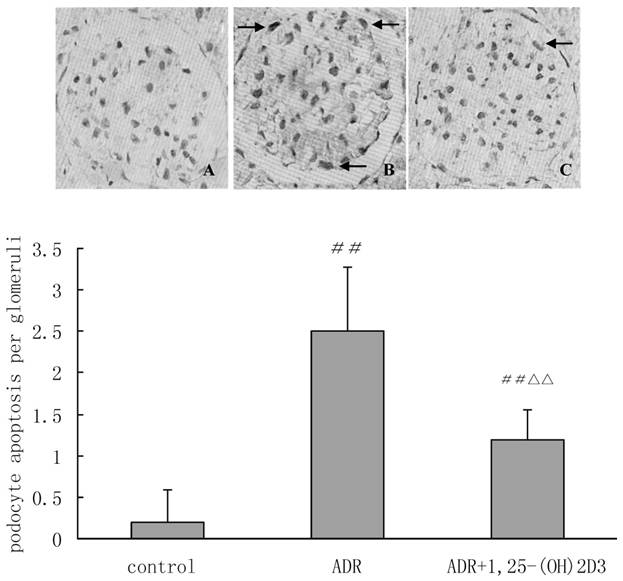 1, 25-dihydroxyvitamin D3 decreases adriamycin-induced podocyte ...
