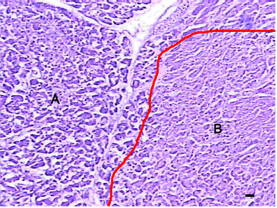 Experimental ablation of the pancreas with high intensity focused ...