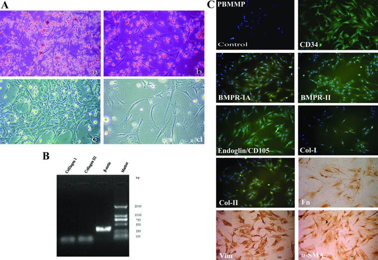 A Novel Population of Mesenchymal Progenitors with Hematopoietic ...