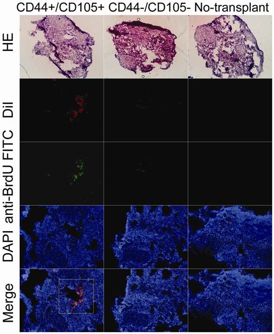 CD44+/CD105+ Human Amniotic Fluid Mesenchymal Stem Cells Survive and ...