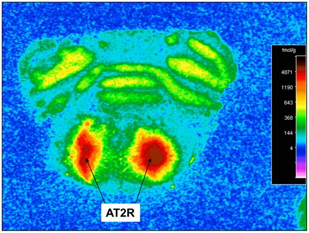 Adenoviral and Adeno-Associated Viral Vectors-Mediated Neuronal Gene ...