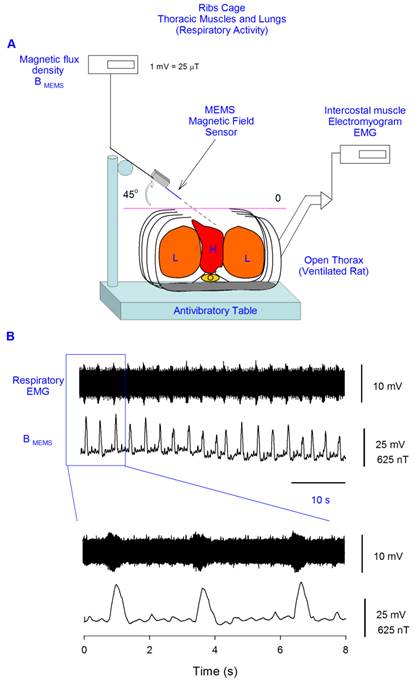 Respiratory Magnetogram Detected with a MEMS Device