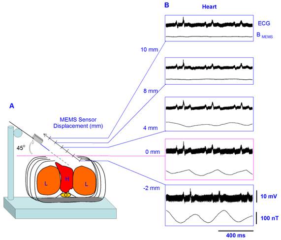Respiratory Magnetogram Detected with a MEMS Device
