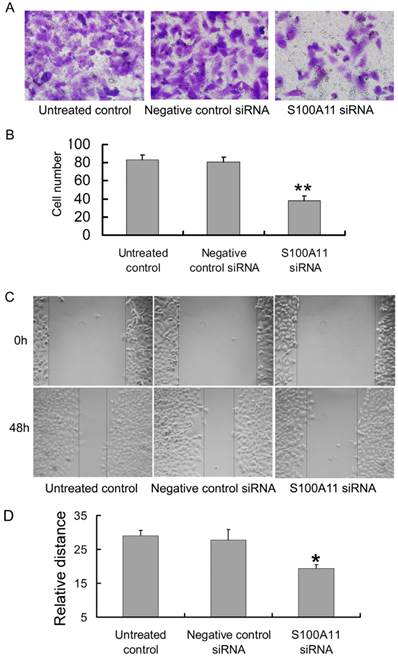 S100A11 Is a Migration-Related Protein in Laryngeal Squamous Cell Carcinoma