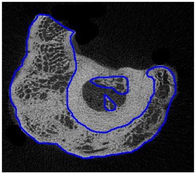Relationship between Microstructure, Material Distribution, and ...