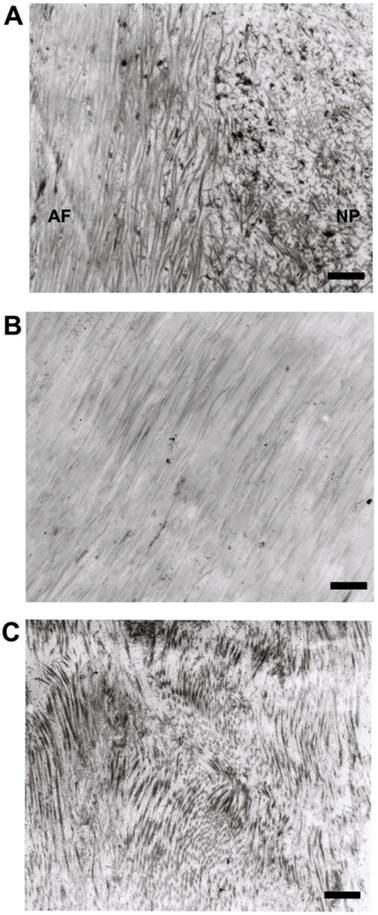 Insights into the Hallmarks of Human Nucleus Pulposus Cells with ...