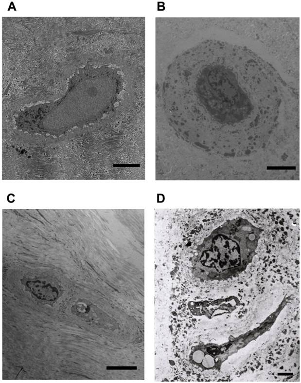 Insights into the Hallmarks of Human Nucleus Pulposus Cells with Particular Reference to Cell ...