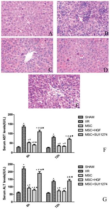 HGF/c-Met Signaling Mediated Mesenchymal Stem Cell-induced Liver ...