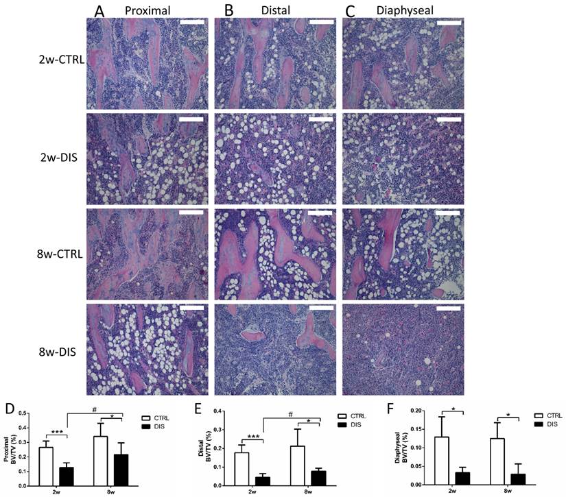 Paradoxical Response to Mechanical Unloading in Bone Loss ...