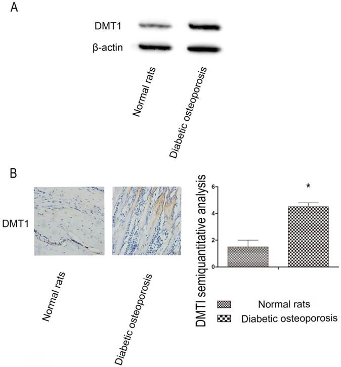 Regulation of DMT1 on Bone Microstructure in Type 2 Diabetes