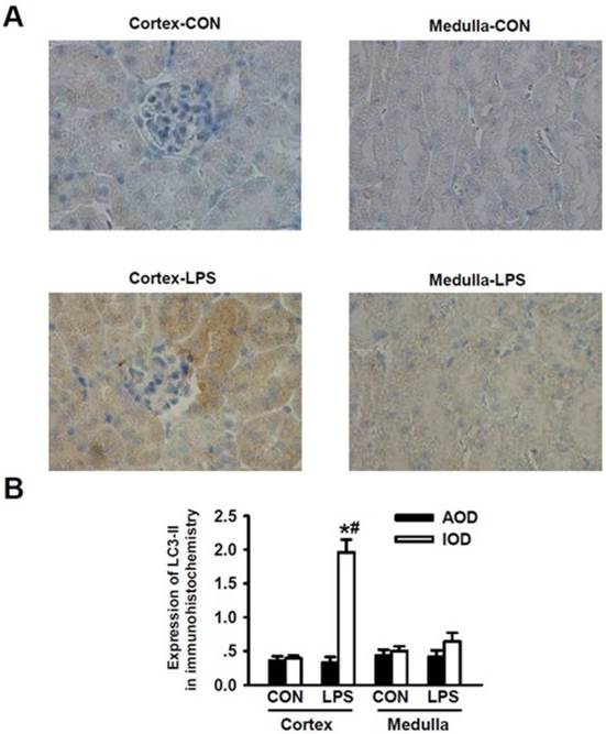 The Role of Autophagy in Kidney Inflammatory Injury via the NF-κB Route ...