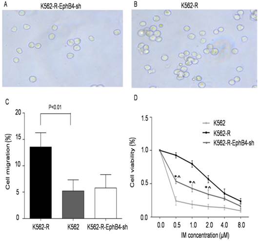 EphB4/ephrinB2 Contributes to Imatinib Resistance in Chronic Myeloid ...