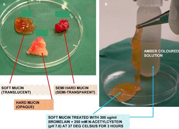 Physical and chemical characteristics of mucin secreted by pseudomyxoma ...