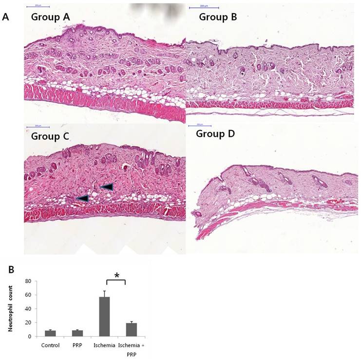 Effect of Platelet-Rich Plasma on Ischemia-Reperfusion Injury in a Skin ...