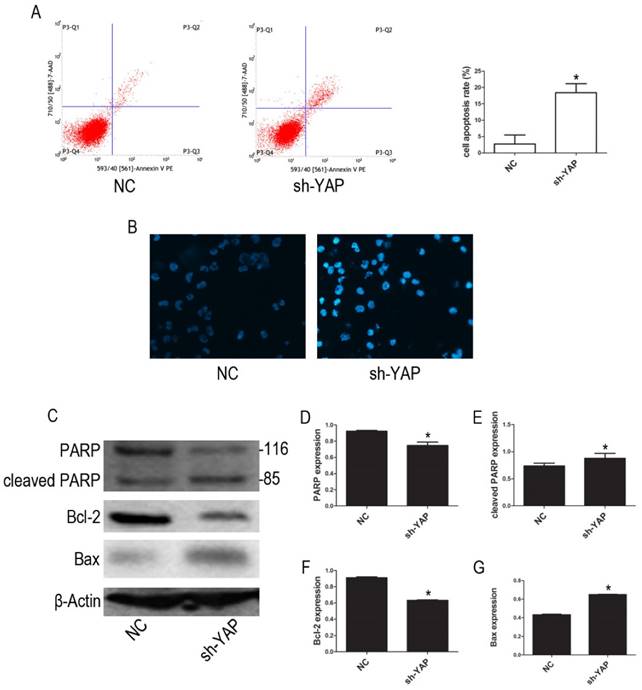 Effect of YAP Inhibition on Human Leukemia HL-60 Cells