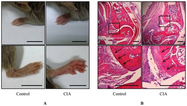 Gene and Protein Expression Profiles in a Mouse Model of Collagen ...