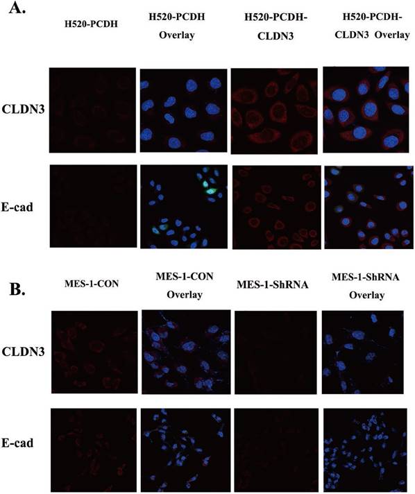 Claudin-3 Inhibits Lung Squamous Cell Carcinoma Cell Epithelial ...