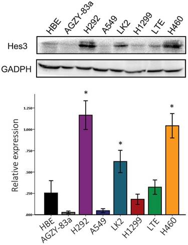 Hes3 Enhances the Malignant Phenotype of Lung Cancer through ...