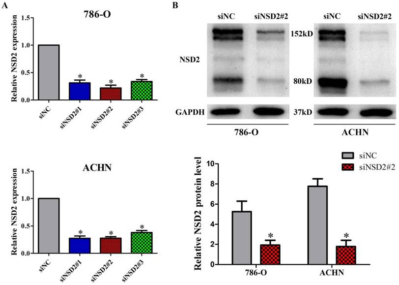 Knockdown of NSD2 Suppresses Renal Cell Carcinoma Metastasis by ...
