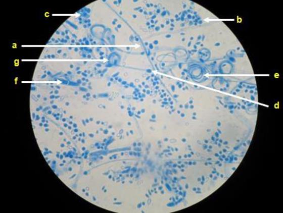 Molecular identification of isolates of the Trichophyton mentagrophytes ...