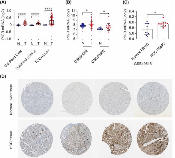 Polymeric immunoglobulin receptor (PIGR) exerts oncogenic functions via ...