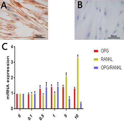 Leptin regulates OPG and RANKL expression in Gingival Fibroblasts and ...