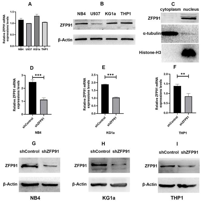 ZFP91 promotes cell proliferation and inhibits cell apoptosis in AML ...