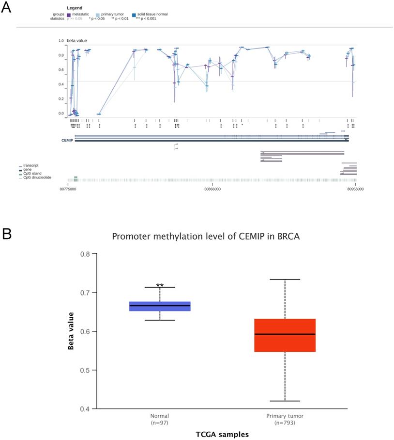 CEMIP as a potential biomarker and therapeutic target for breast cancer ...