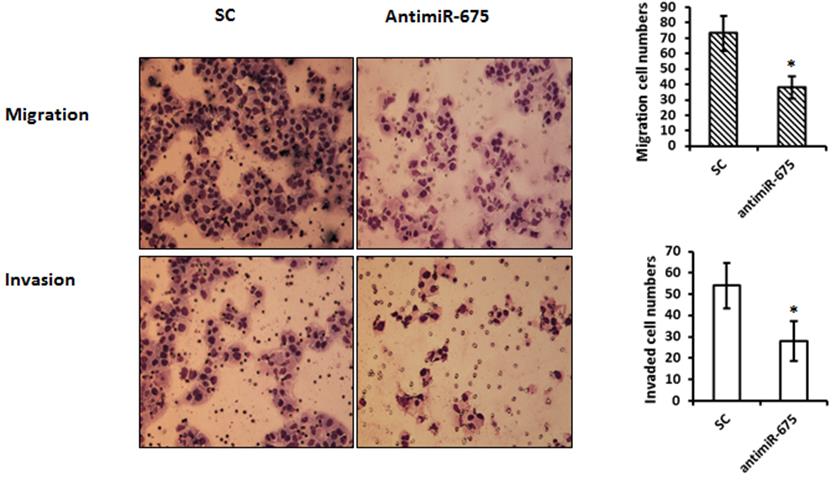 Overexpression of lncRNA H19/miR-675 promotes tumorigenesis in head and ... Overexpression of lncRNA H19/miR-675 promotes tumorigenesis in head and ...