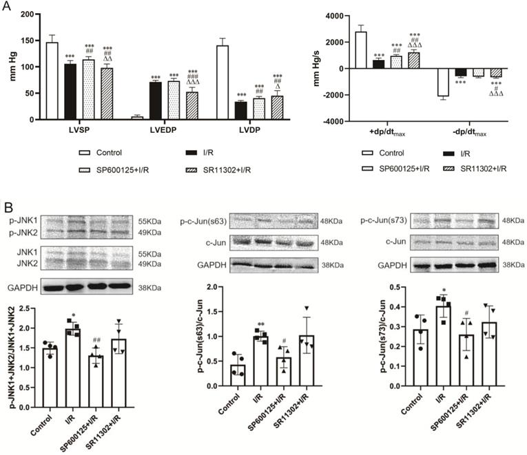 Targeting IRE1α-JNK-c-Jun/AP-1-sEH Signaling Pathway Improves ...