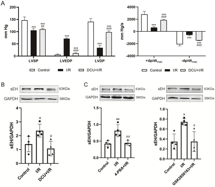 Targeting IRE1α-JNK-c-Jun/AP-1-sEH Signaling Pathway Improves ...